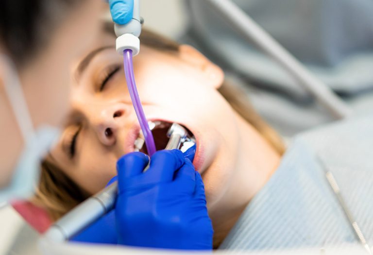 Sistemas de aspiración dental - CONTACT DENTAL